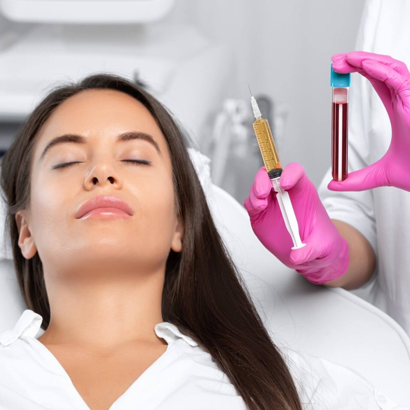 Platelet-Rich Fibrin (PRF) - Essential Beauty Medical Spa & Laser Center